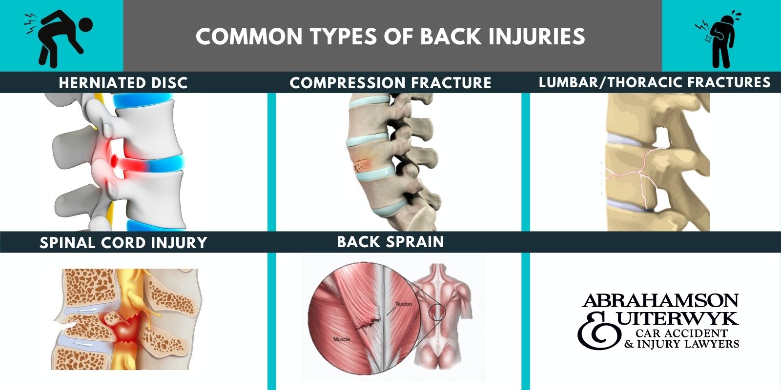 Tampa Back Injury Lawyer - 30+ Yrs Experience - Millions $ Recovered