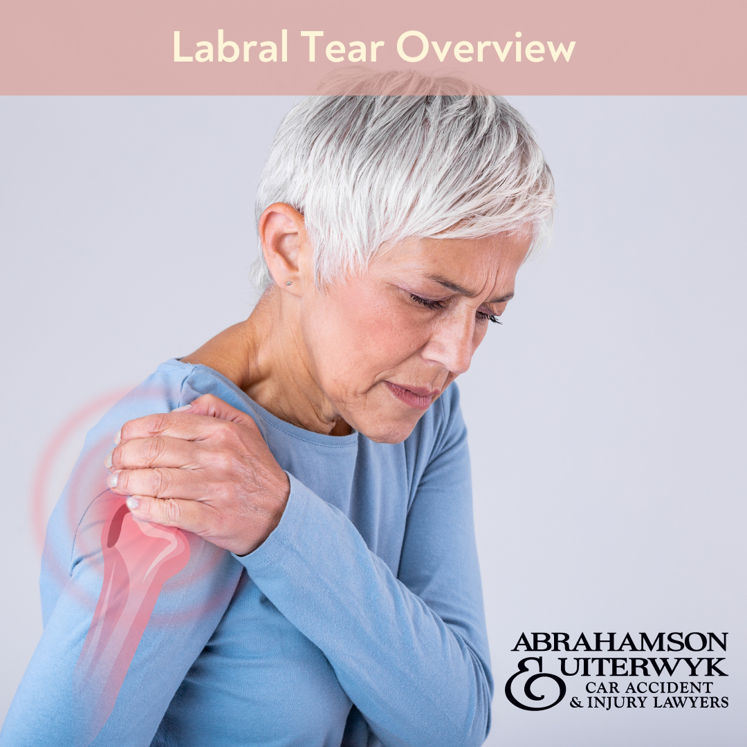 Recent Labral Tear Shoulder Settlement in FL – Florida Settlement ...