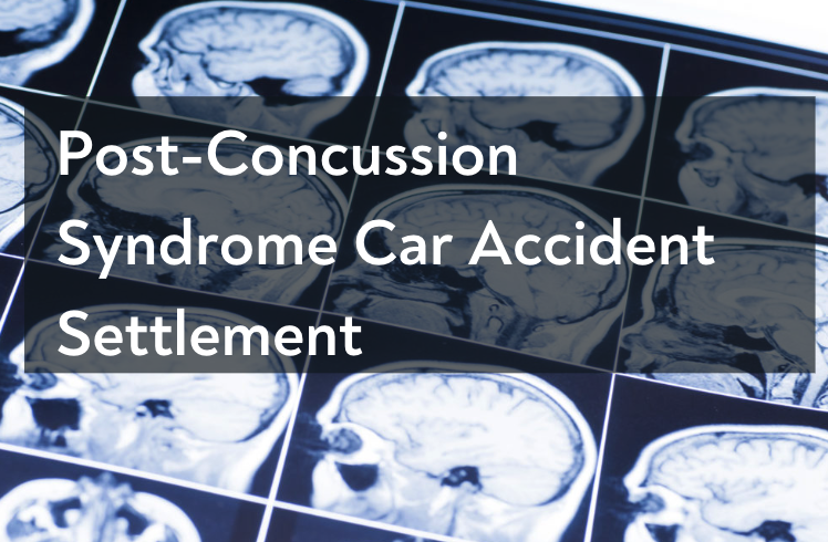Recent Post Concussion Syndrome Car Accident Settlements In FL - Florida Settlement Amounts ...